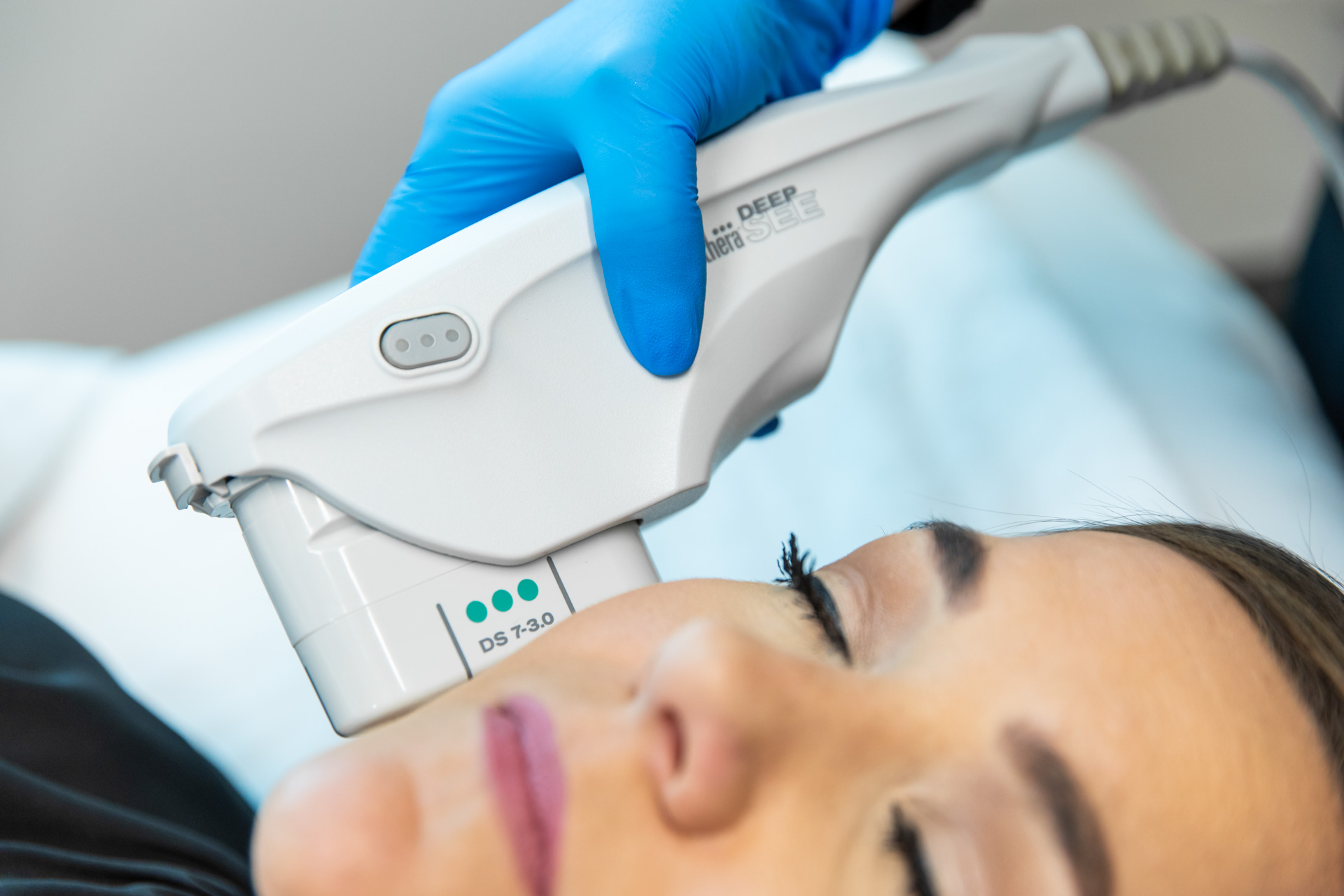 Get Nicer-Looking Skin with Laser Resurfacing - Ovation Med Spa